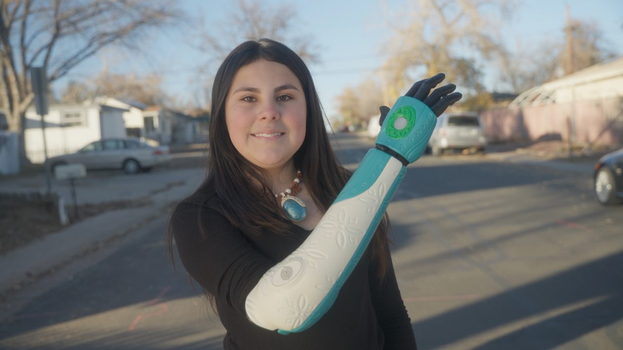 Open Bionics 为四名莫阿纳粉丝开发定制假肢 - CHINAdditive